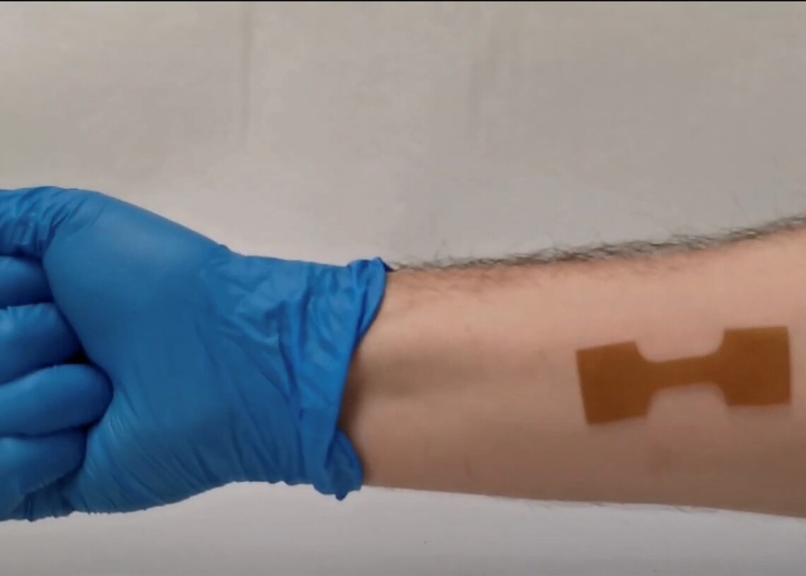 Un pansement intelligent pourrait soulager la douleur des patients brûlés